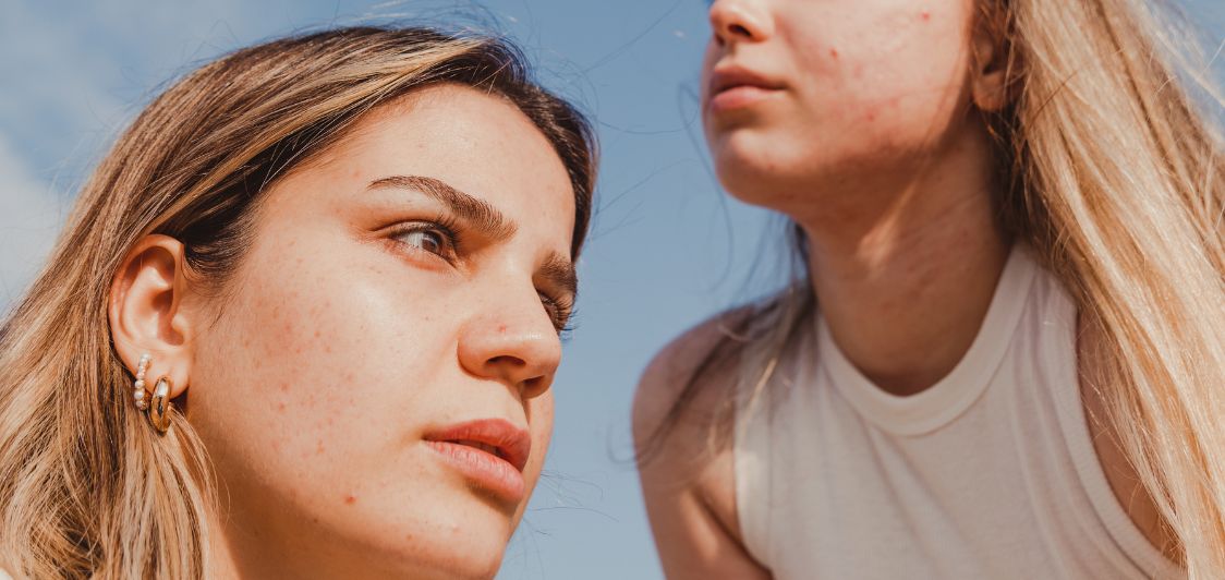 REBOUND-EFFEKT: UNSER RAT ZUR VERMEIDUNG VON IMPERFEKTIONEN NACH DEM S ...